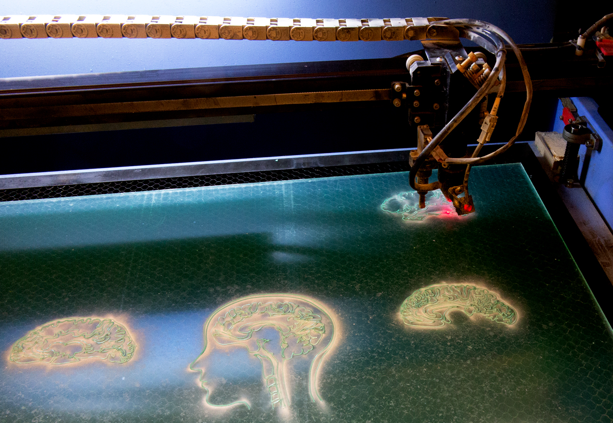 Inside my brain: lasers and gold - VsQ - The Visual Squirrels